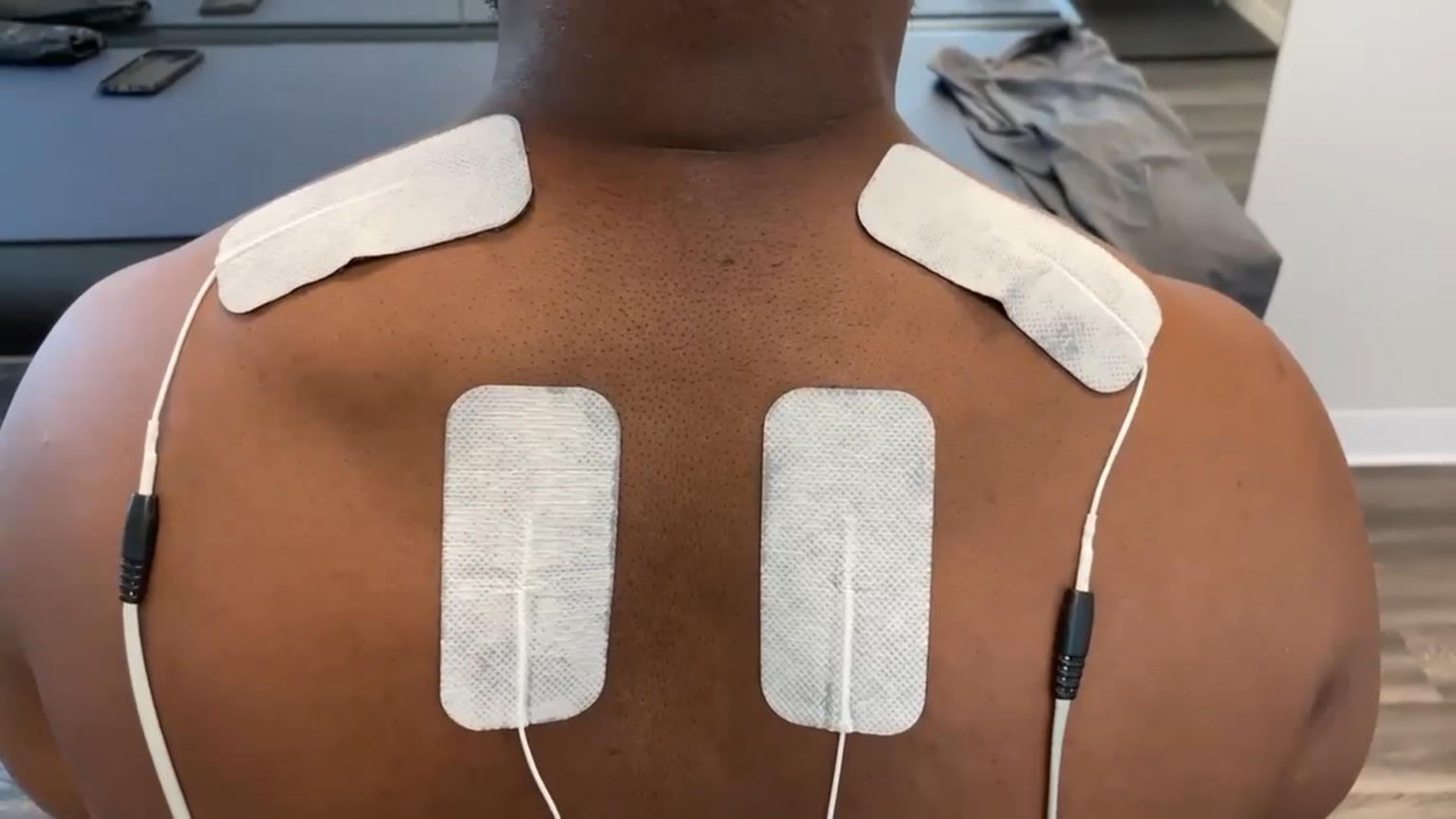 Neck and Back Pain Fixed with ARPwave Therapy - Neuro Sports ...